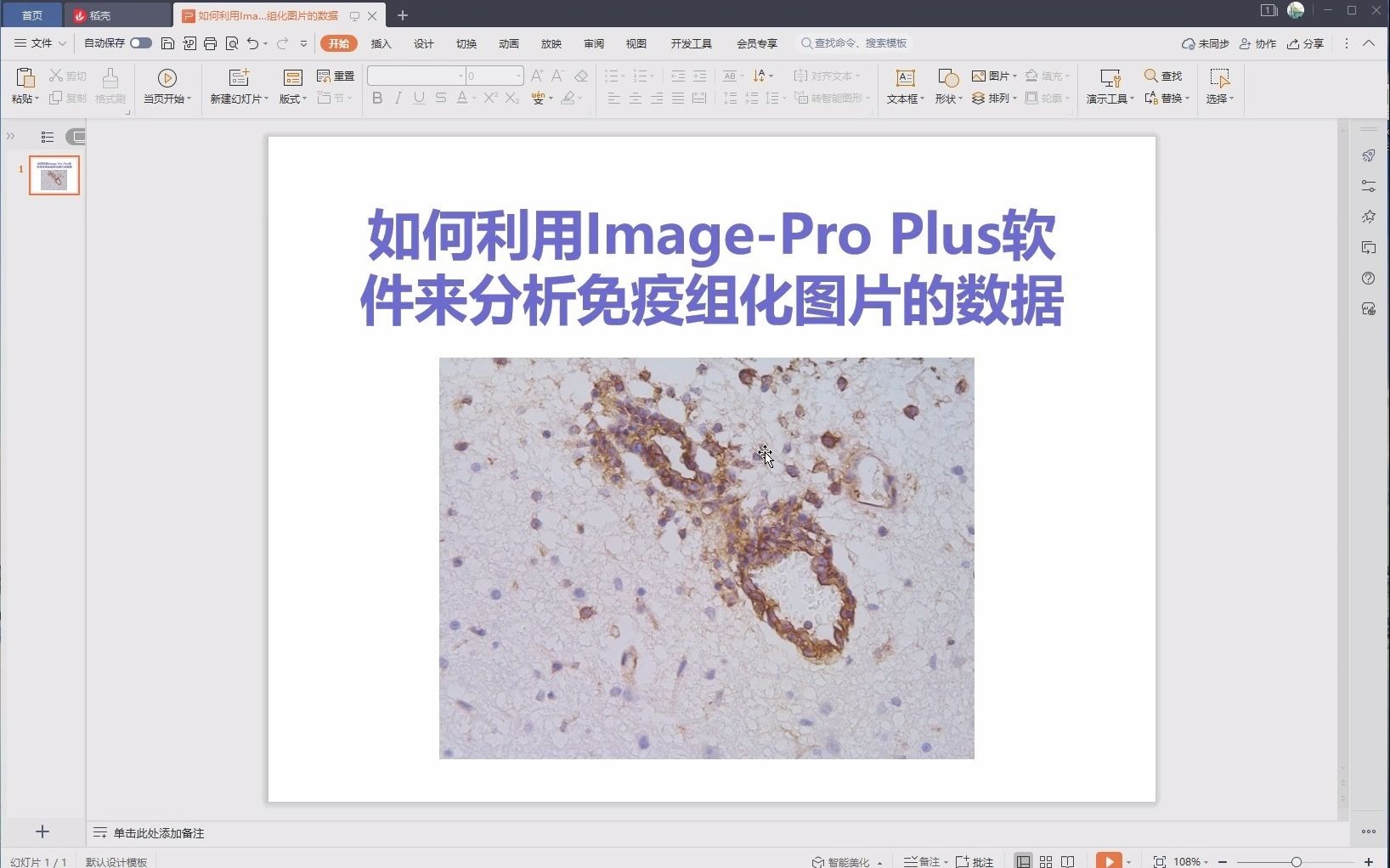 如何利用Image-Pro Plus软件来分析免疫组化图片的数据_哔哩哔哩_bilibili