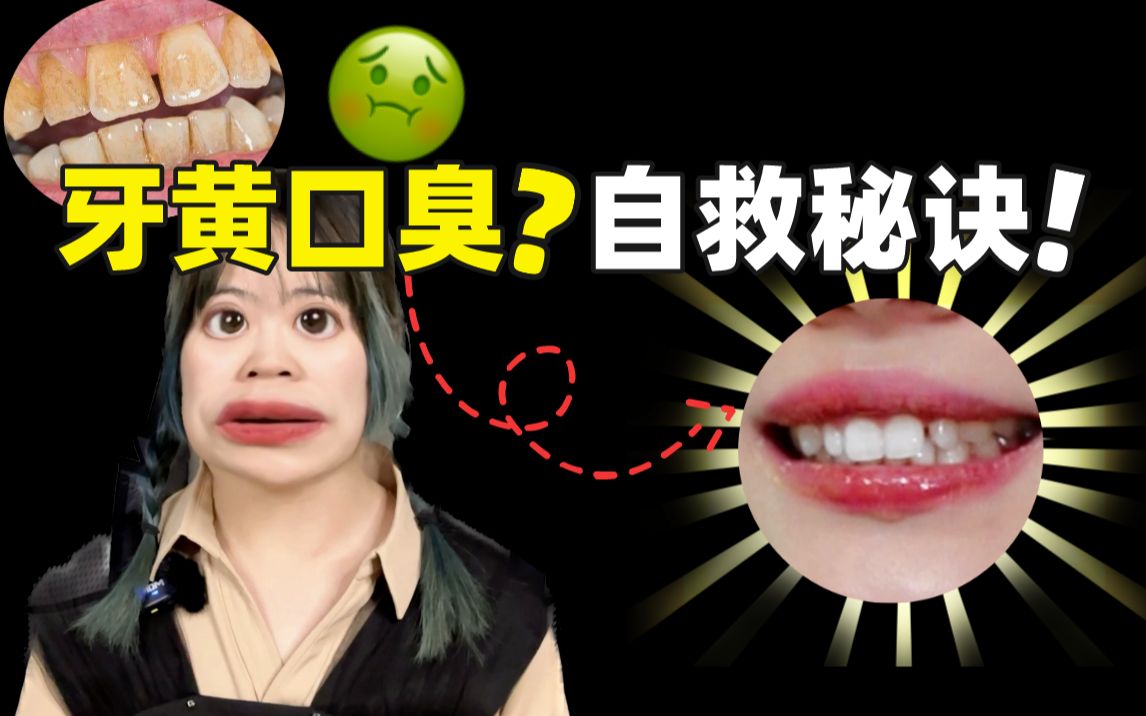 牙黄口臭怎么刷牙都不见效?亲测有效!告诉你解决办法! 爱吃草莓的加菲酱 爱吃草莓的加菲酱 哔哩哔哩视频