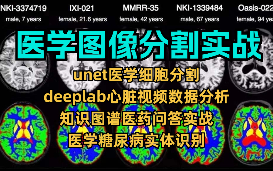 【医学图像分割实战教程】unet医学细胞分割、deeplab心脏视频数据分析、知识图谱医药问答实战、医学糖尿病实体识别！原理详解+项目实战，CV新手必学！-机器学习算法实战大全-机器学习算法 ...