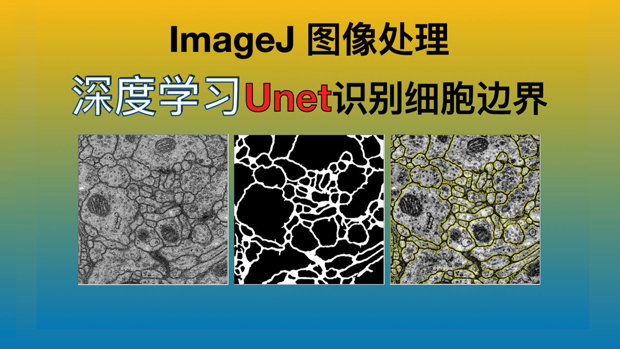 『超实用』ImageJ图像处理 - 深度学习Unet区分处理识别细胞膜 DeepImageJ使用指南-思语视觉-思语视觉-哔哩哔哩视频