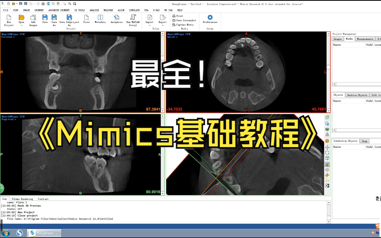 Mimics21 基础命令视频教程-代先-医疗-哔哩哔哩视频