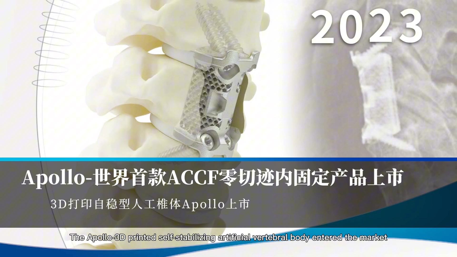 研究了15年的3d打印技术，在骨科领域展现光彩 爱康医疗 爱康医疗 哔哩哔哩视频