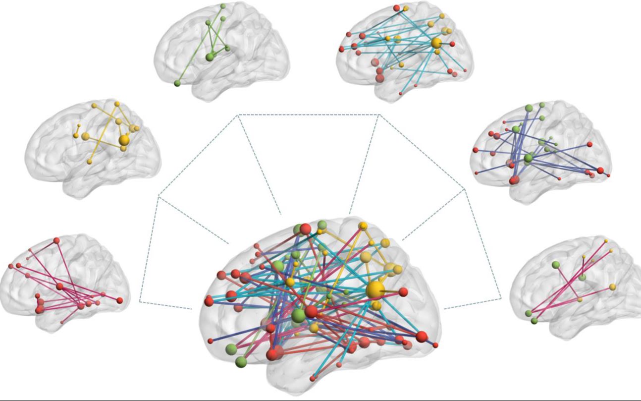 BrainNetViewer操作实例_哔哩哔哩_bilibili