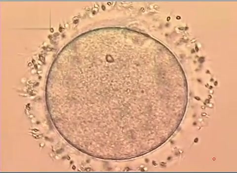 精子试图进入一个卵子_显微镜下真实观察录像。_哔哩哔哩_bilibili