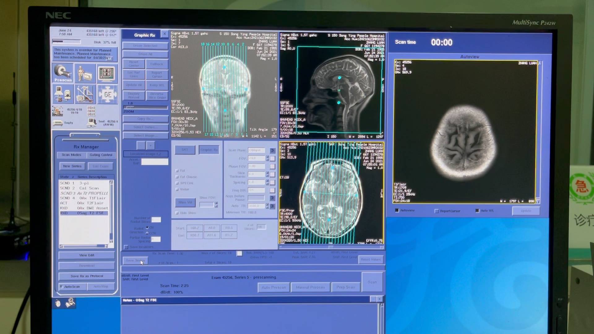 GE磁共振颅脑MRI扫描流程（新手篇）_哔哩哔哩_bilibili