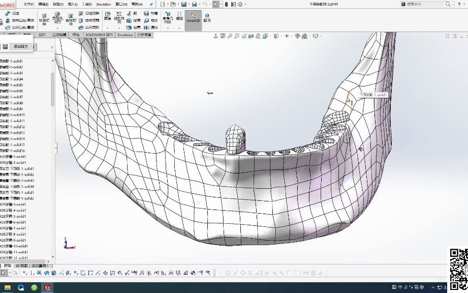 口腔生物力学-正畸（3）SolidWorks牙齿跟牙槽骨的固定配合、术后模型处理_哔哩哔哩_bilibili
