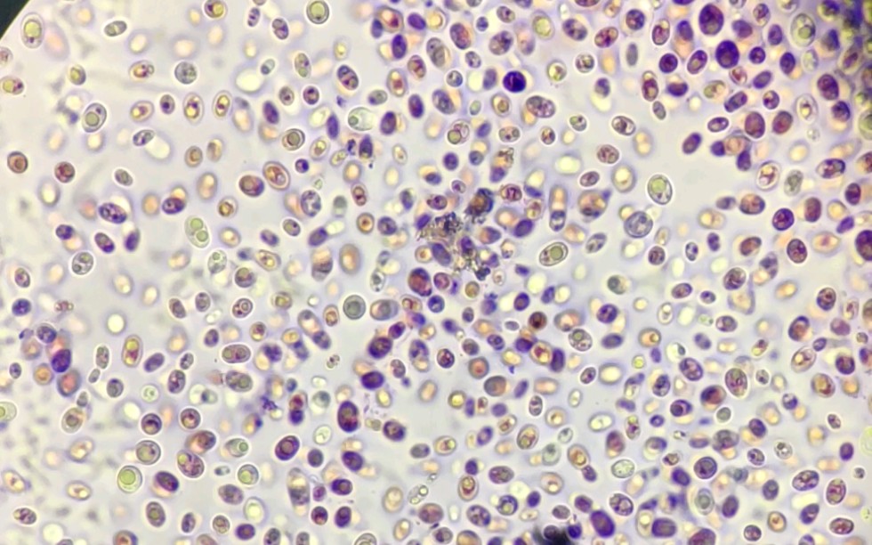 显微镜下的酵母_哔哩哔哩_bilibili