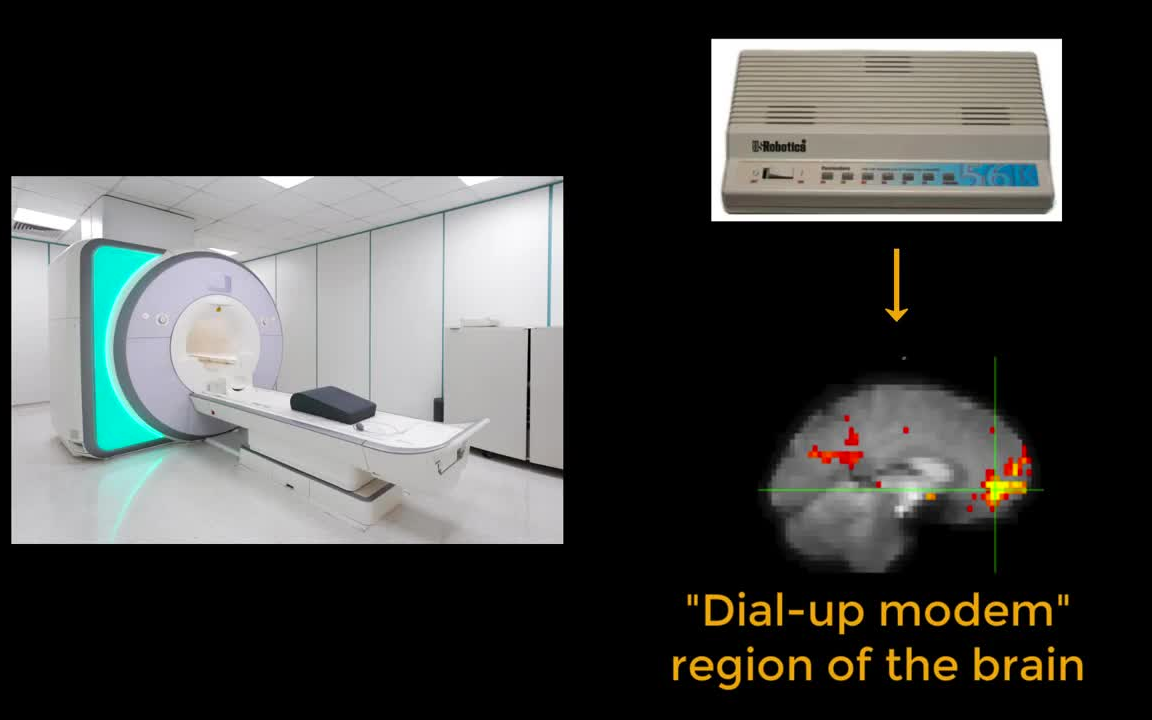 Functional Connectivity with the CONN Toolbox(2020)_fMRI analysis ...