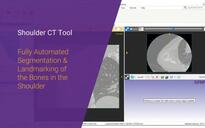 Simpleware软件的基本了解视频 - 哔哩哔哩