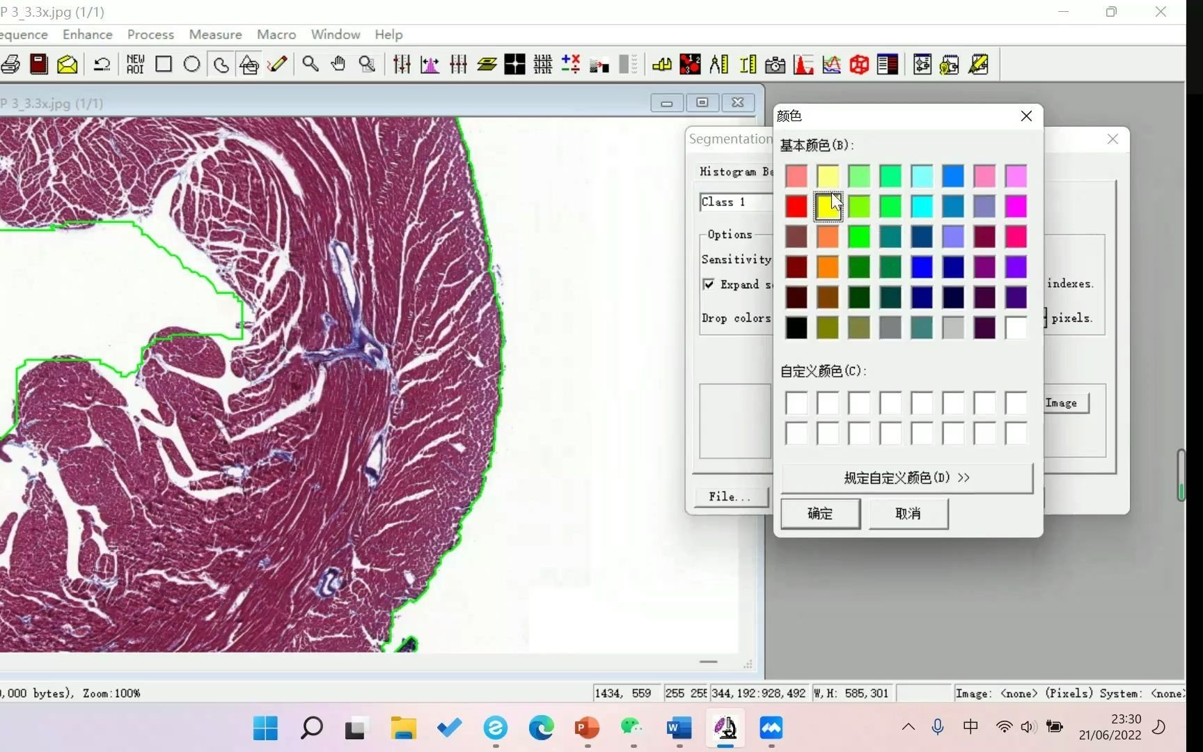 Image Pro Plus进行Masson染色统计 - 视频下载 Video Downloader