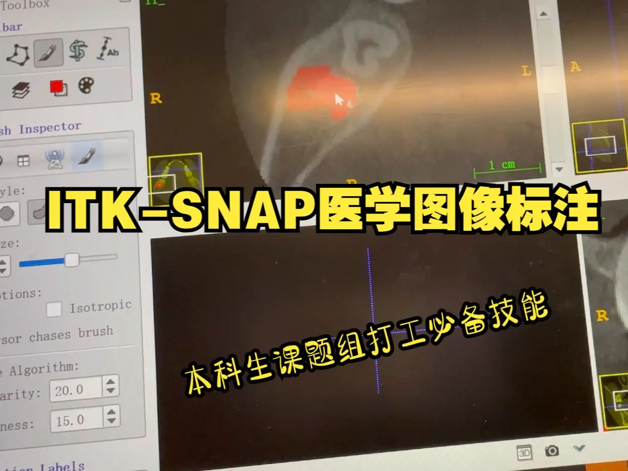 医学图像分割ITK-SNAP软件标注教学_哔哩哔哩_bilibili