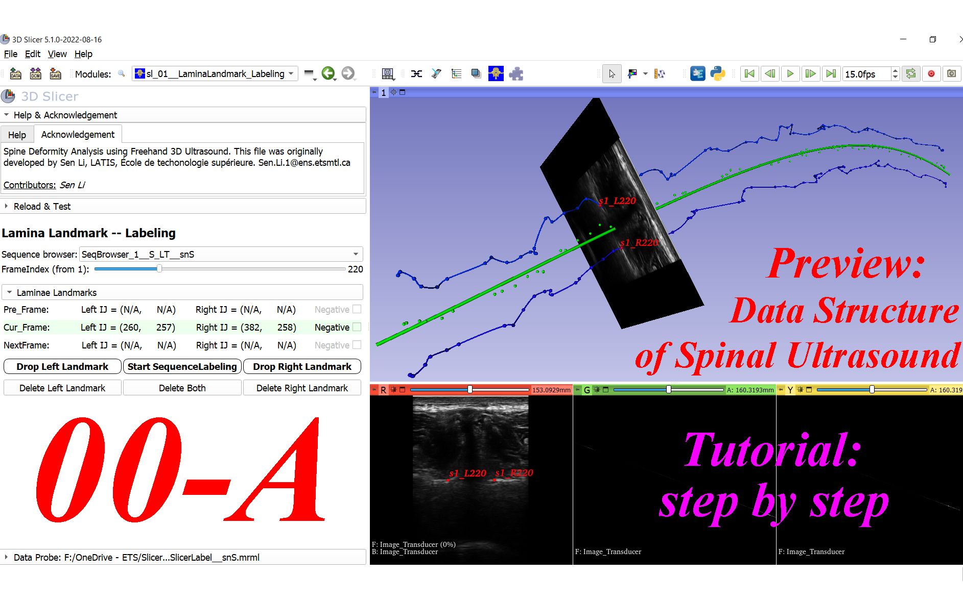 Lamina Landmark Labeling. #00-A. Preview -- data structure of spinal ...