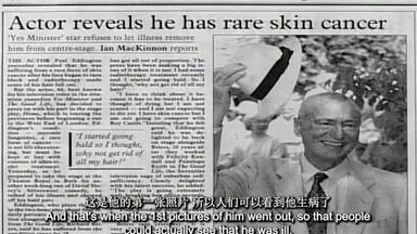 Paul Eddington Skin Cancer