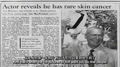 Paul Eddington Skin Cancer