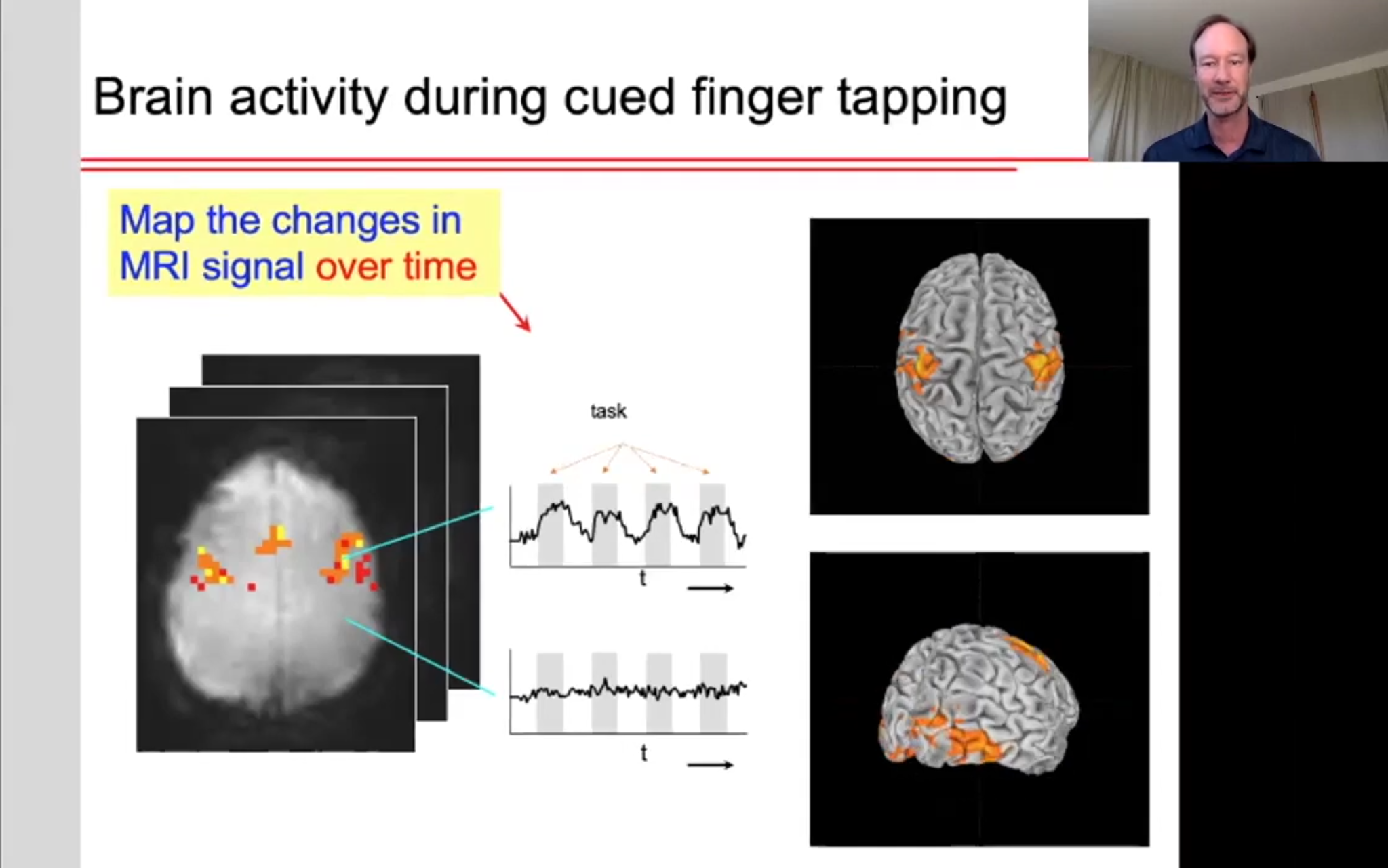 功能磁共振数据分析 fMRI Analysis_哔哩哔哩_bilibili