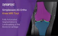 Simpleware软件的基本了解视频 - 哔哩哔哩