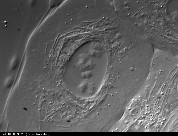 显微镜下初级精母细胞的减数第一次分裂_哔哩哔哩_bilibili