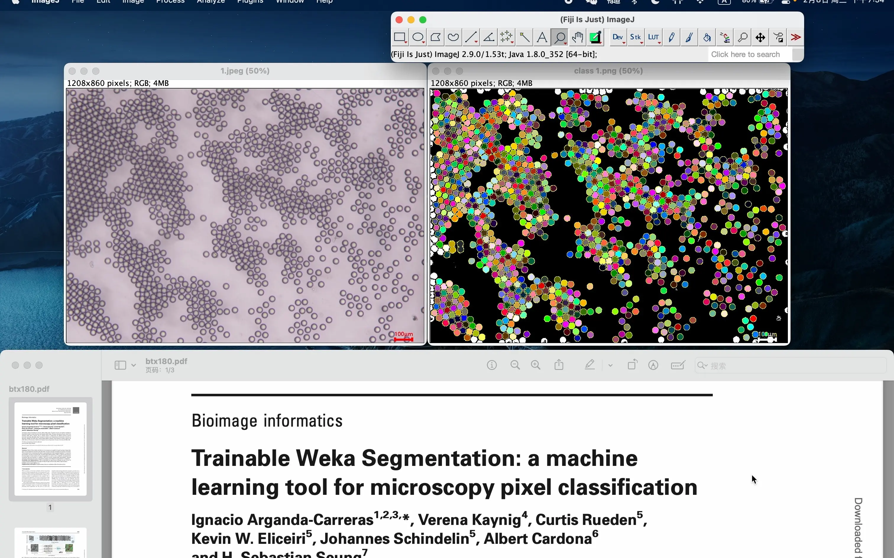 Fiji ImageJ 第23讲——用机器学习插件Trainable Weka Segmentation分析液滴的数目和形态_哔哩哔哩_bilibili