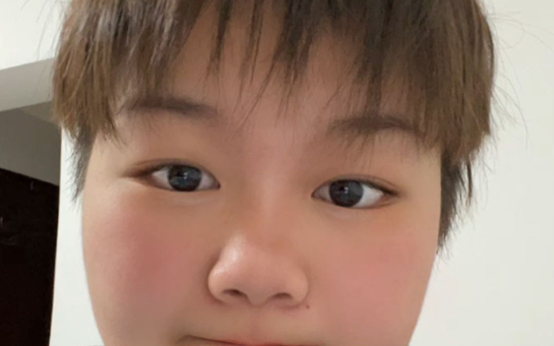 MECT治疗经历分享_哔哩哔哩_bilibili