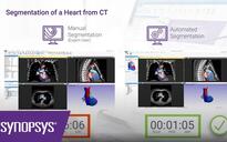 Simpleware软件的基本了解视频 - 哔哩哔哩